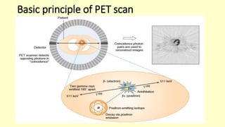 Nuclear medicine for cardiothoracic surgeons | PPTX