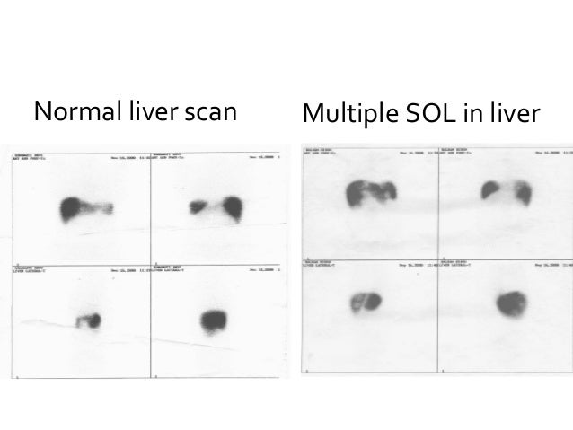 Nuclear medicine in gastroenterology