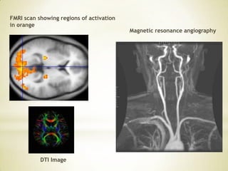 Nuclear mri | PPT