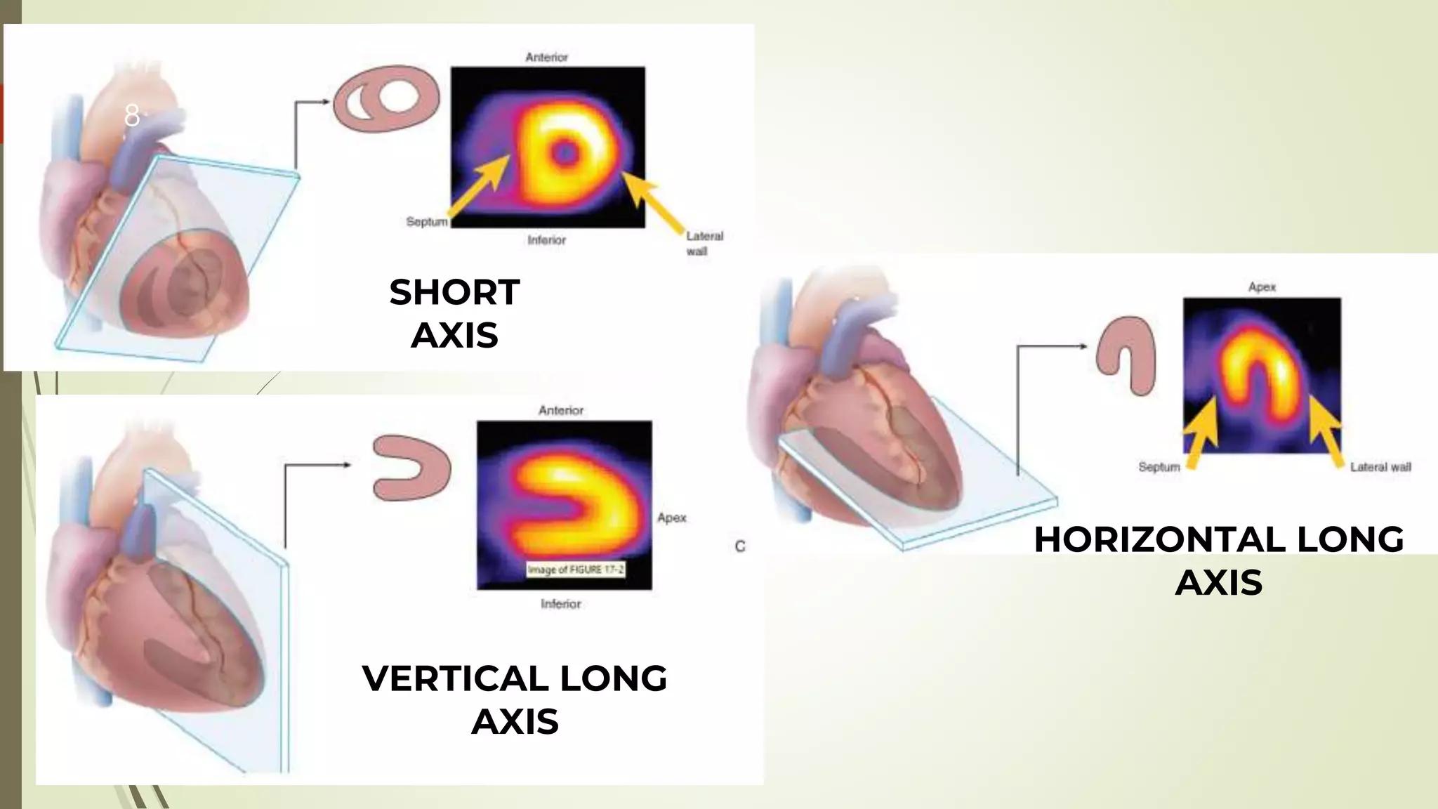 Nuclear Radiology.pptx