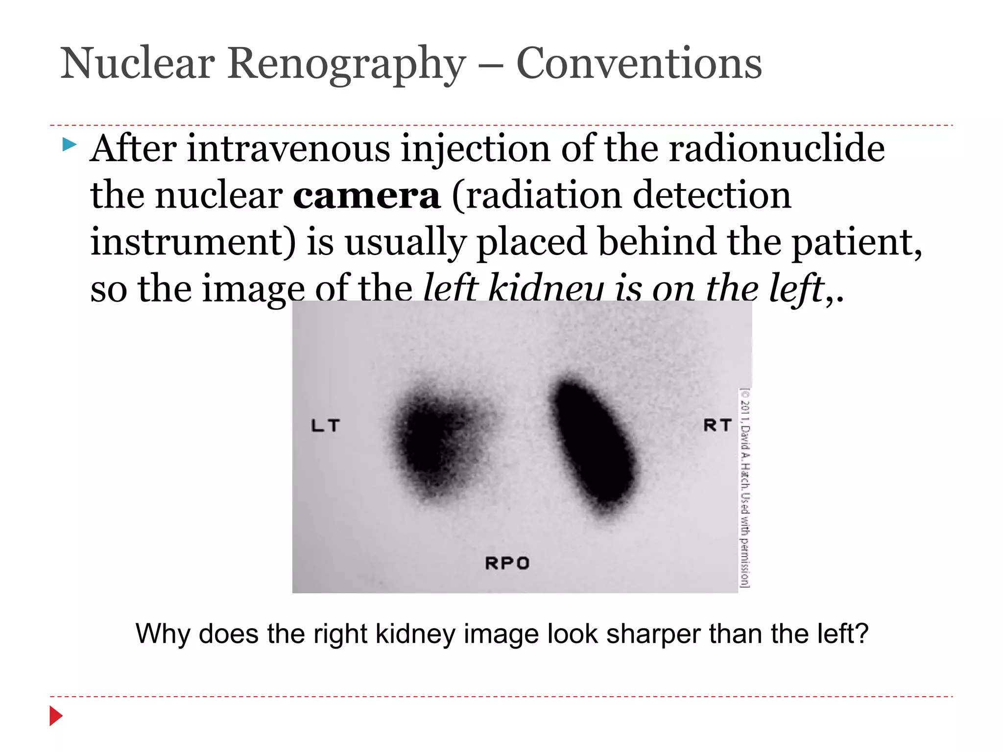 Nuclear renography | PPT