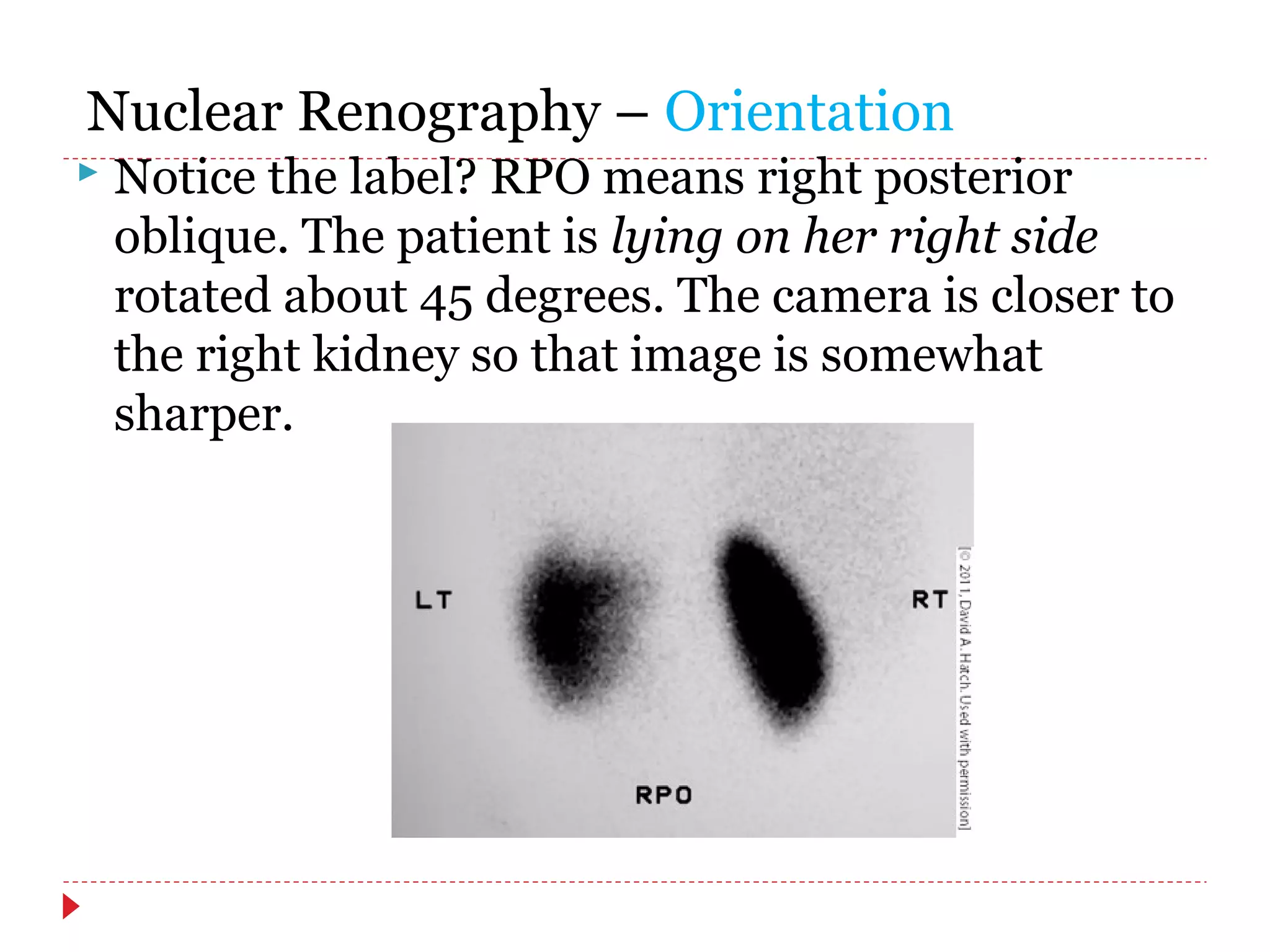 Nuclear renography | PPT