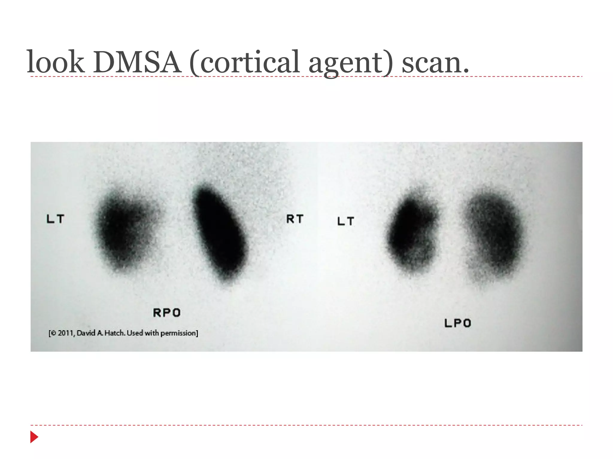 Nuclear renography | PPT
