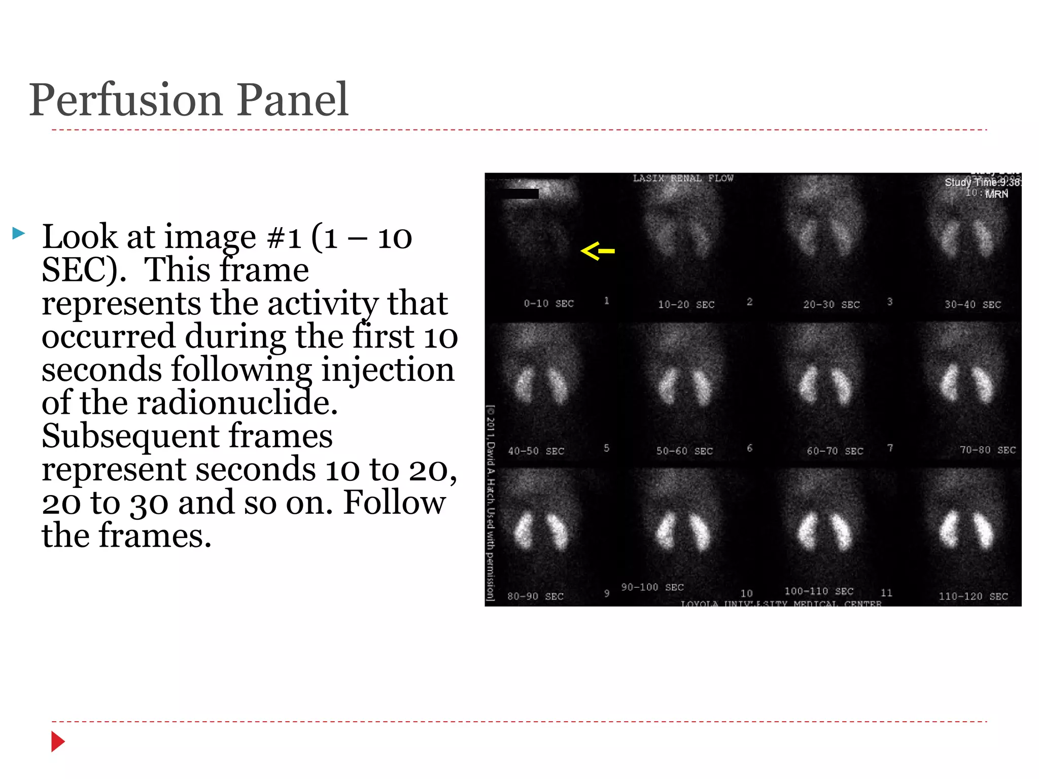Nuclear renography | PPT