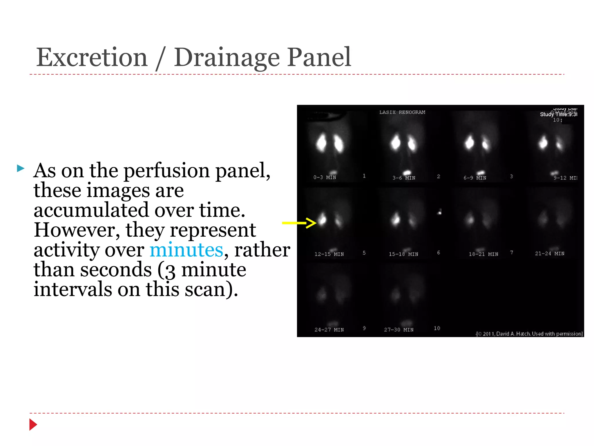 Nuclear renography | PPT