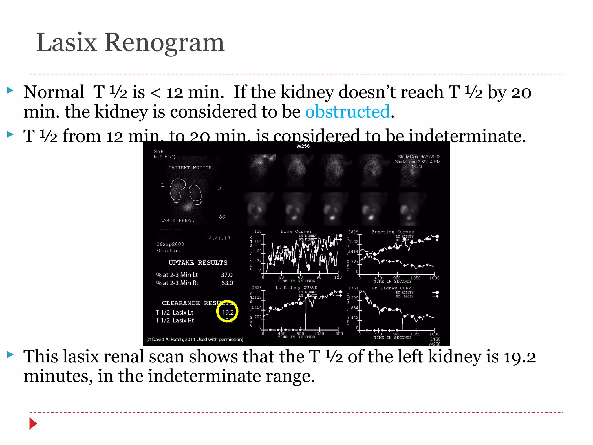 Nuclear renography | PPT