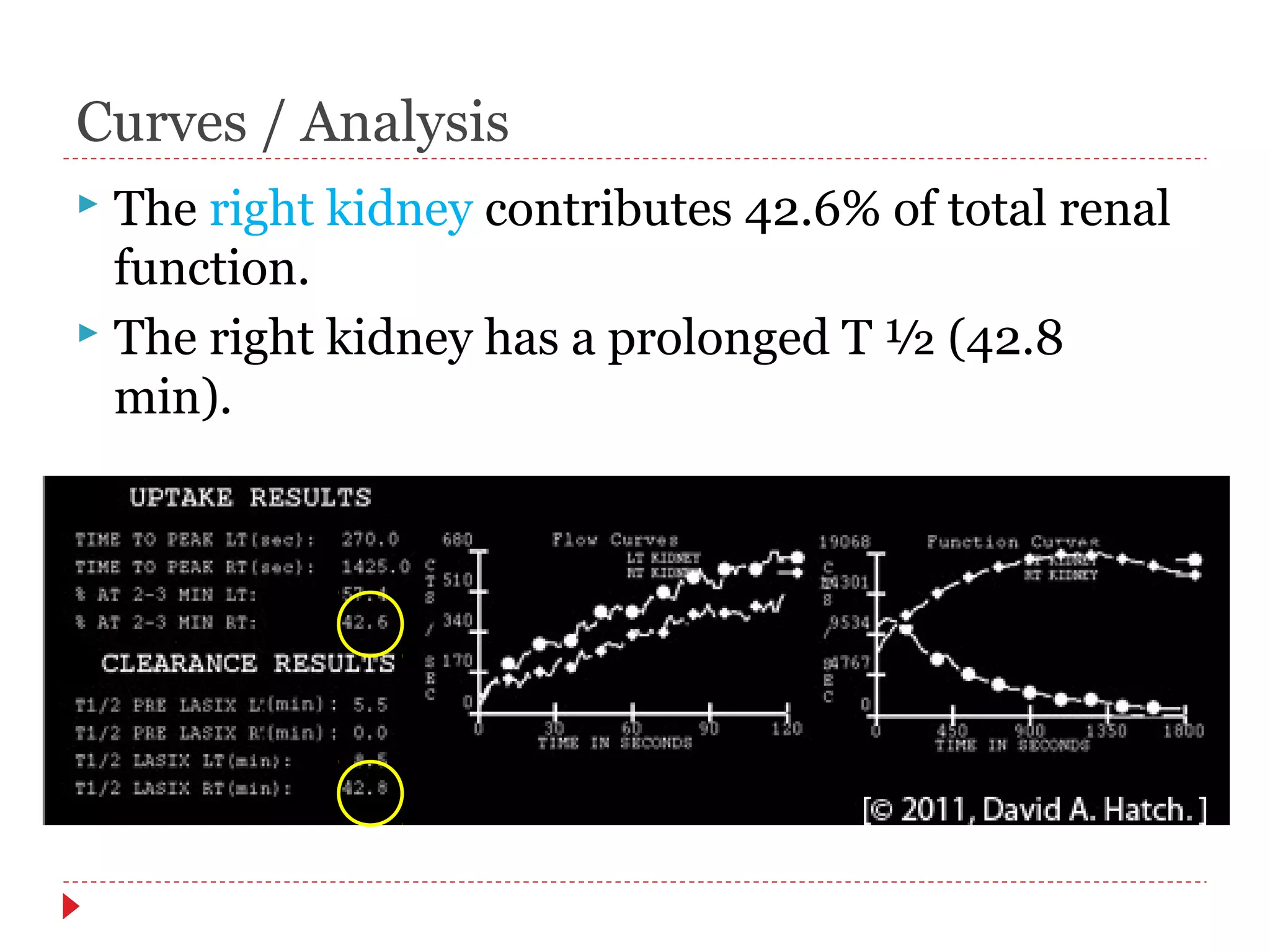 Nuclear renography | PPT