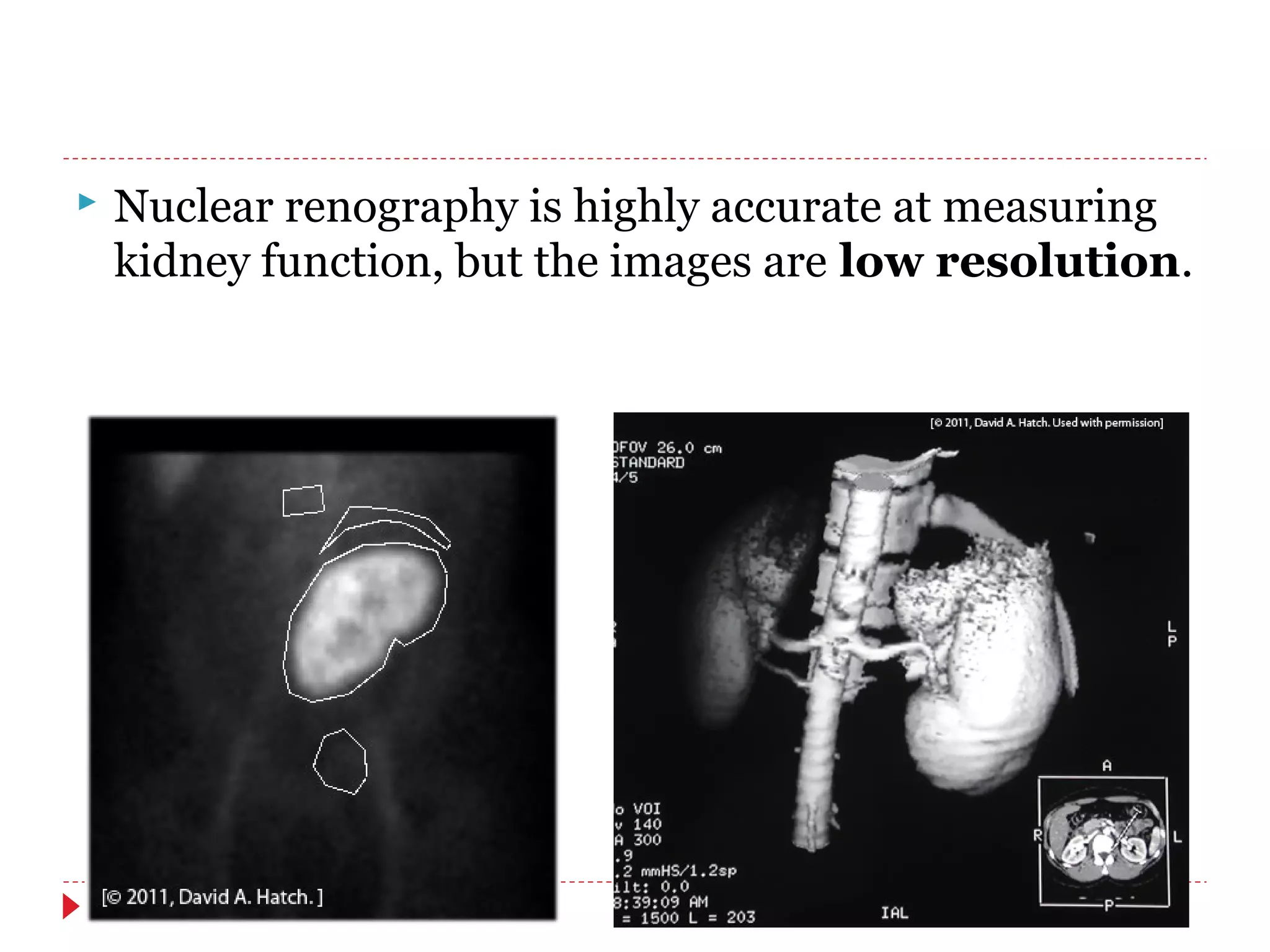 Nuclear renography | PPT