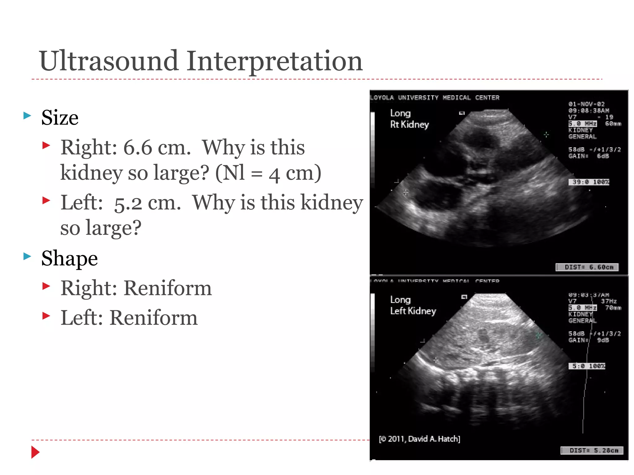 Nuclear renography | PPT