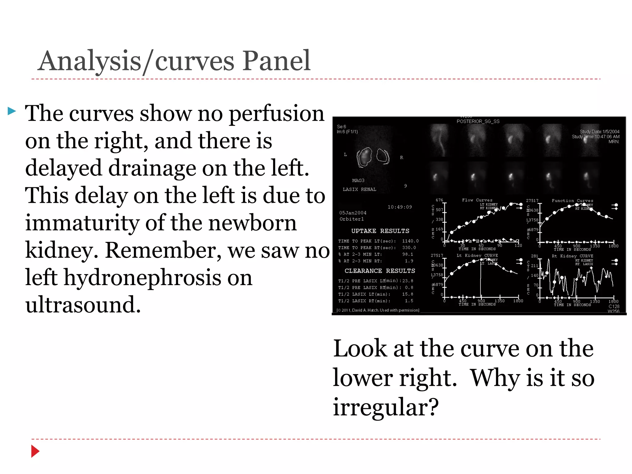 Nuclear renography | PPT