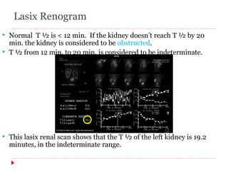 Nuclear renography | PPT