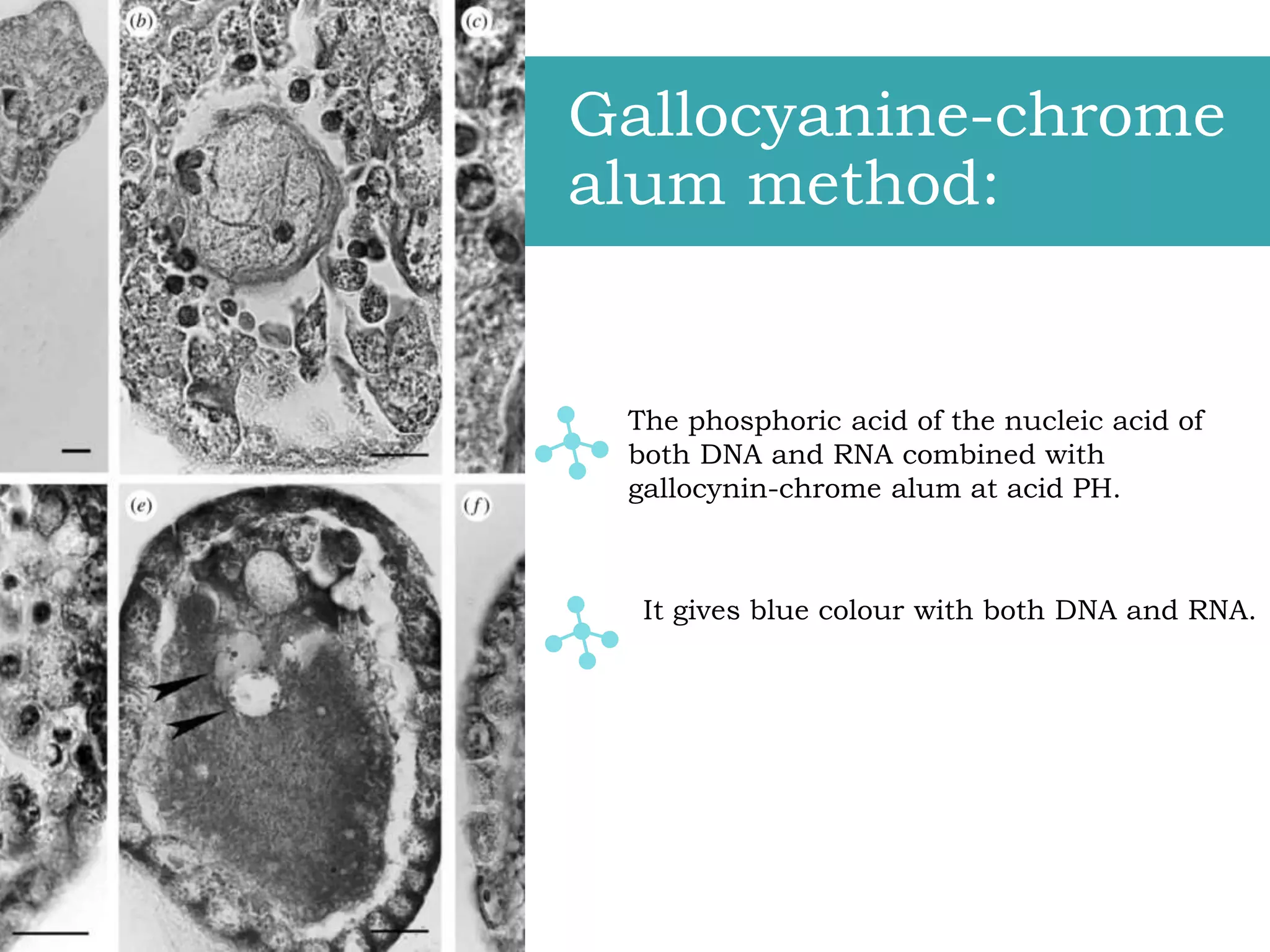 Nucleic acids (DNA+RNA) demonstration in histopathology | PPTX
