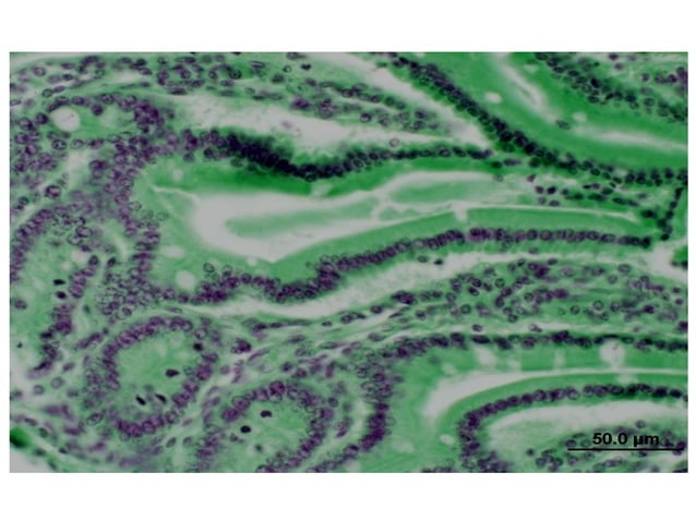 Nucleic acid stains | ODP