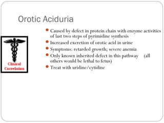 Orotic Aciduria Usmle
