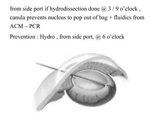 Nucleus drop - SN | PPTX