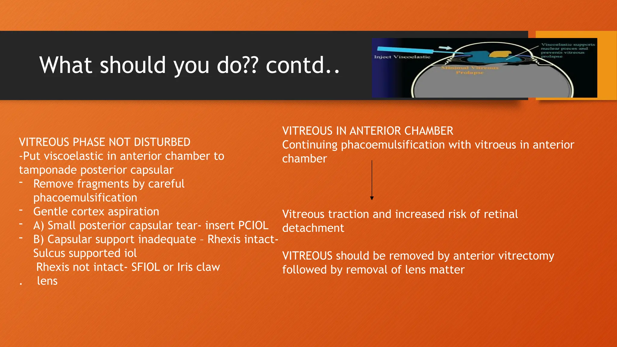 Complications of cataract surgery - nucleus drop | PPTX