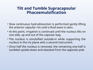 Nucleus management during phaco surgery.ppt
