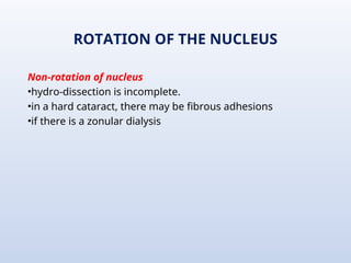 Nucleus management during phaco surgery.ppt