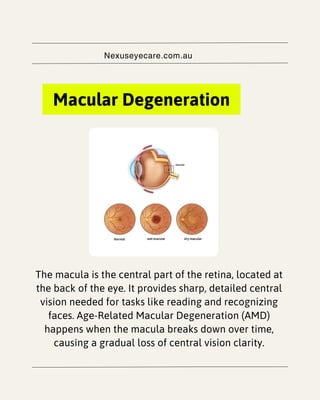 Retinal and Macular Diseases: Know Your Choices | PDF