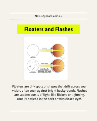 Retinal and Macular Diseases: Know Your Choices | PDF
