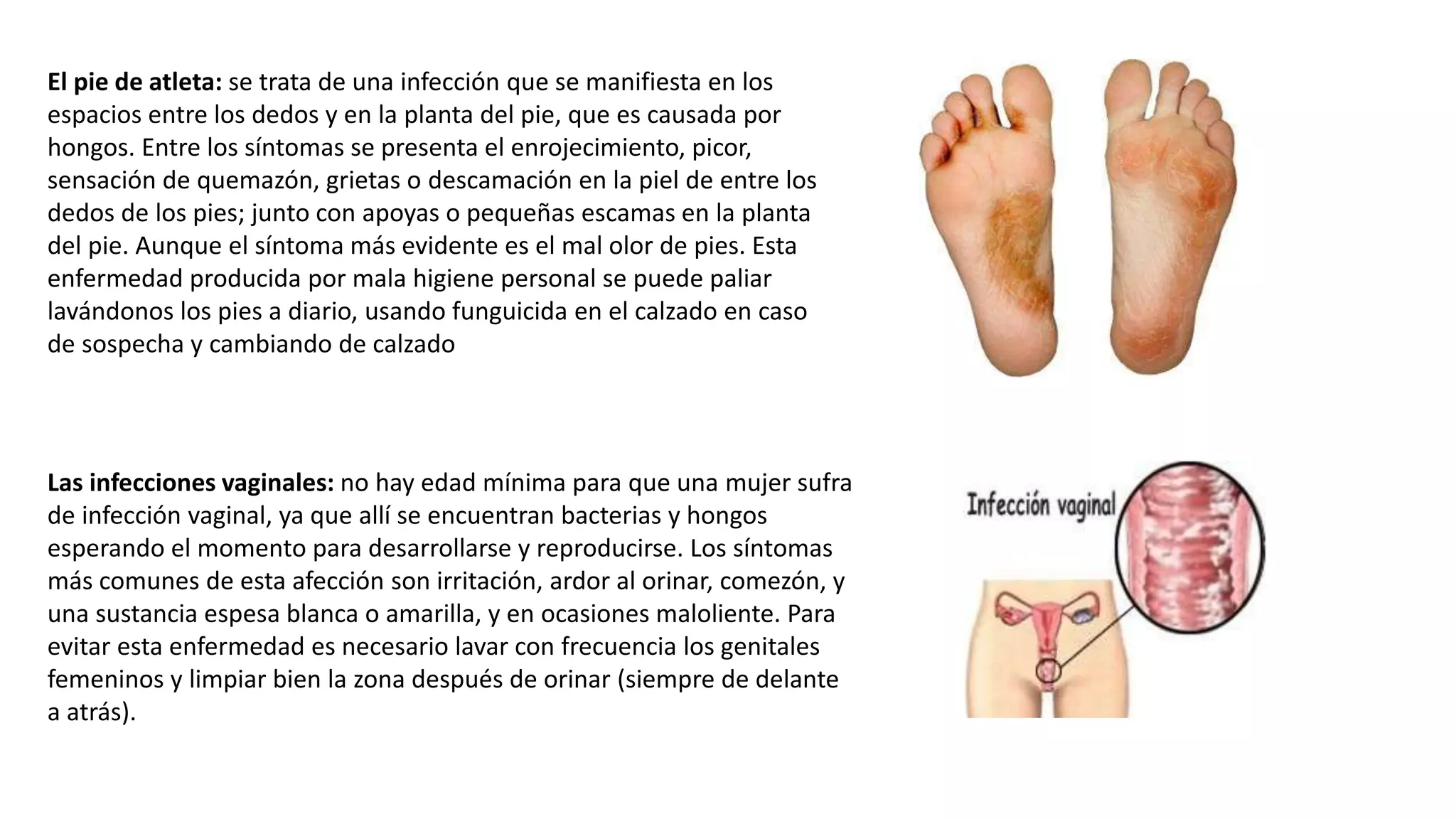 enfermedades causadas por la falta de higiene | PPTX