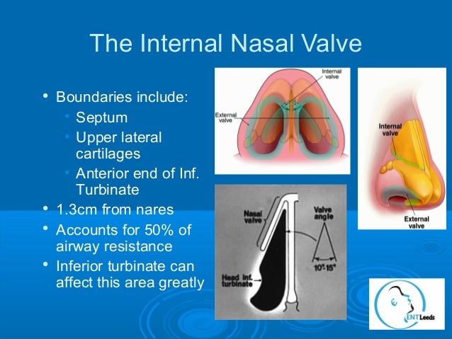 “Doctor, I’m bunged up!” A GP’s guide to managing blocked noses and