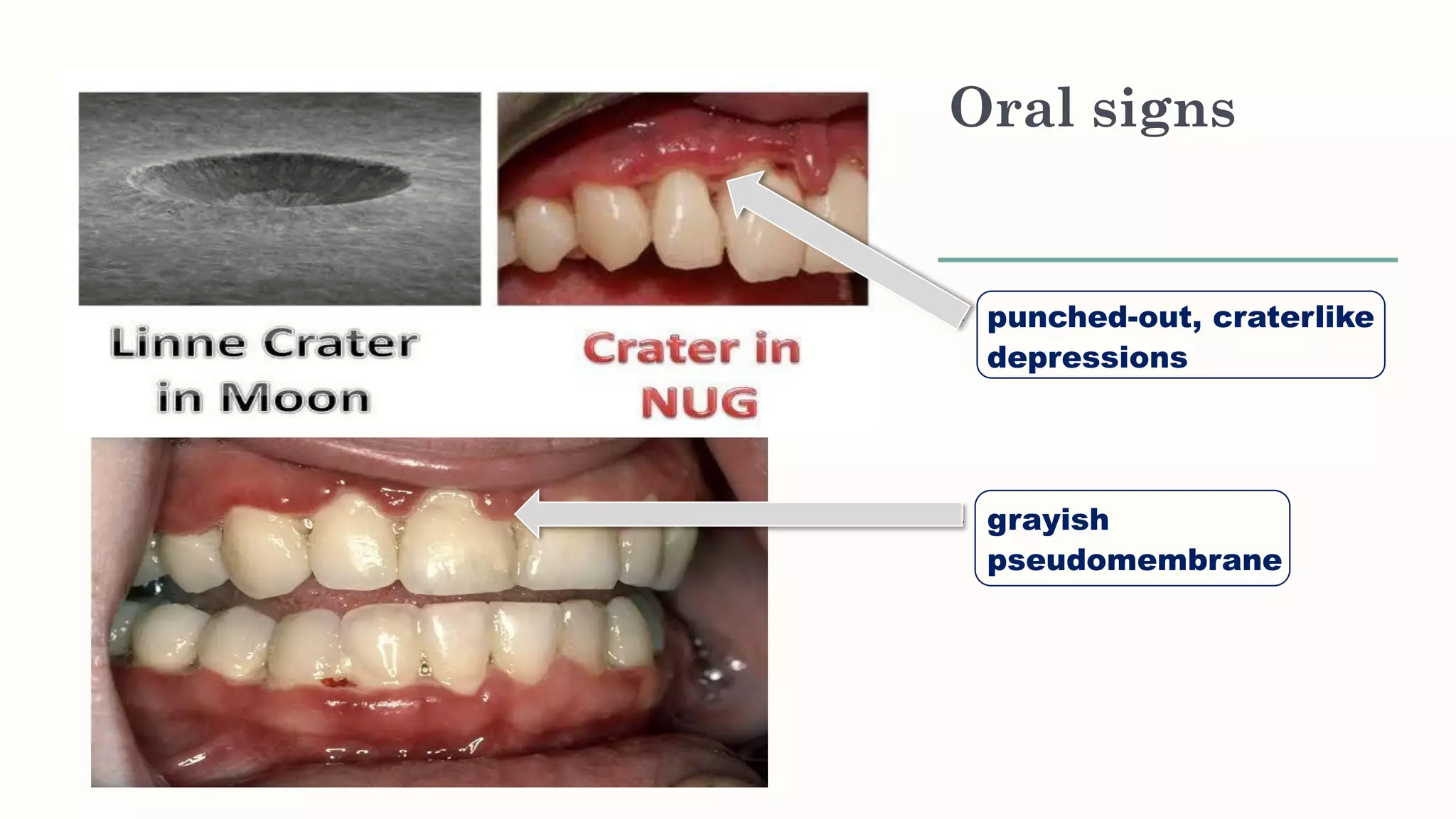 (Nug) and (nup) | PDF