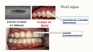 (Nug) and (nup) | PDF