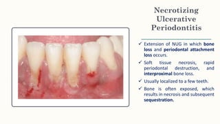 Necrotizing Ulcerative Gingivitis Vs Necrotizing Ulcerative Periodontitis