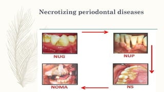 (Nug) and (nup) | PPT