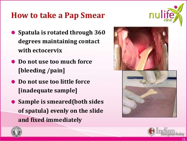 Nulife module 6 screening for malignancies edited