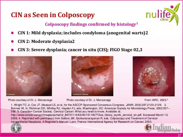 Nulife Module 6 Screening For Malignancies Edited