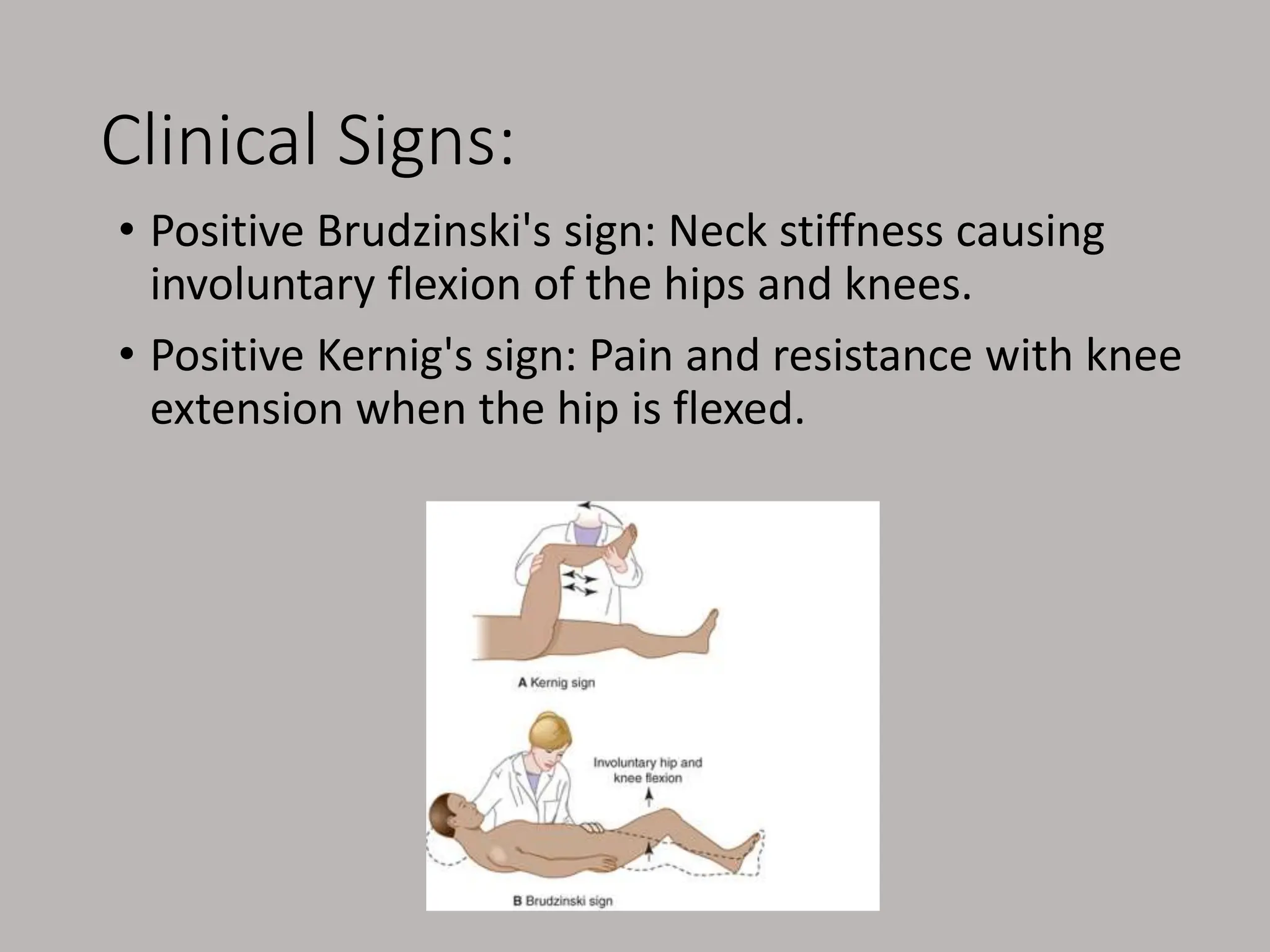 Meningococcal Meningoencephalitis overview | PPTX