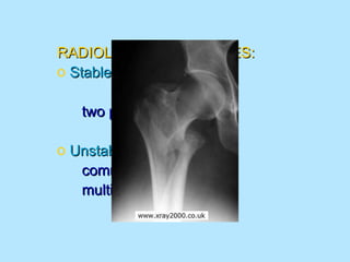 fracture neck of femur and trochanteric fracture | PPT