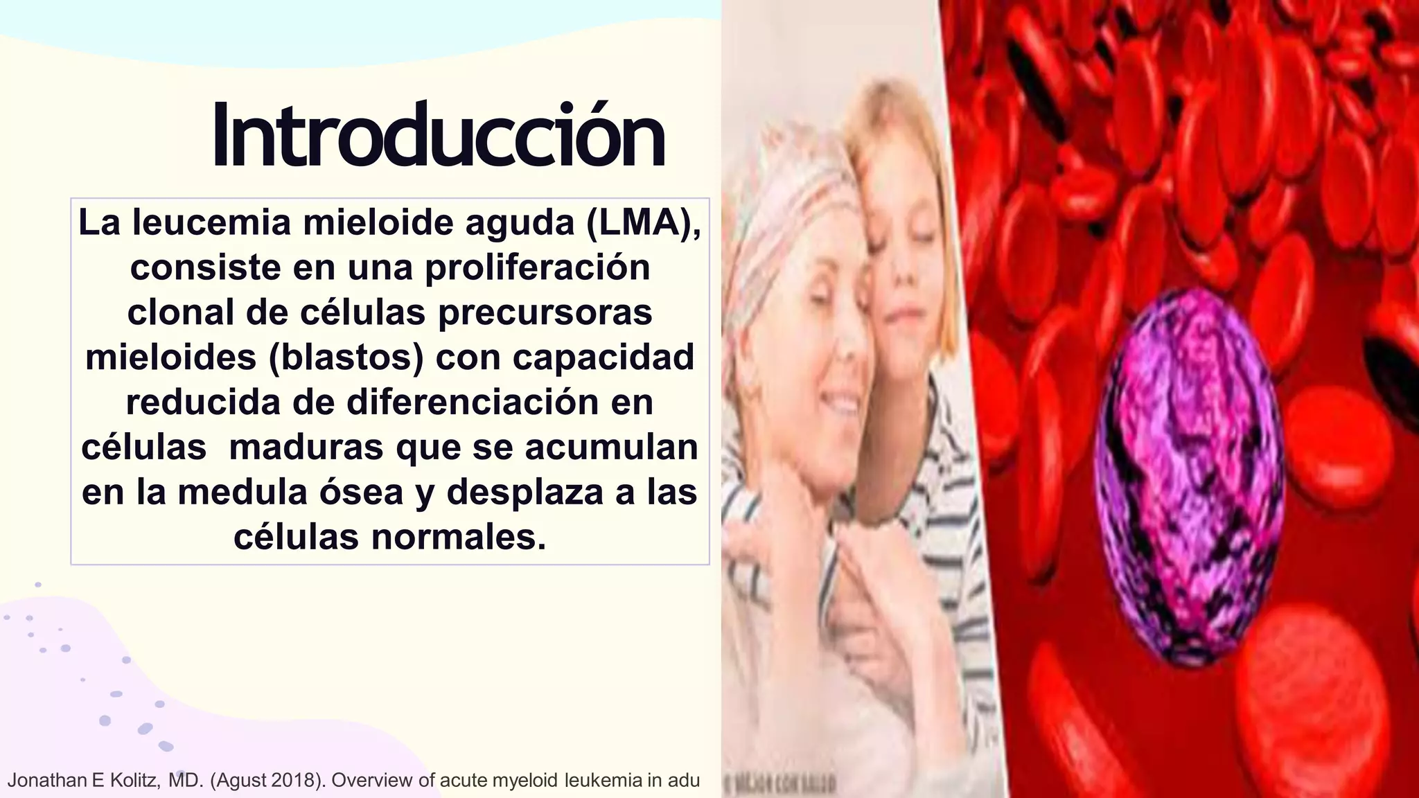 Leucemia Mieloide aguda.pptx