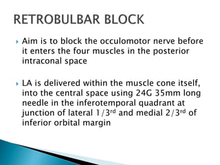 regional and topical ocular anaesthesia in ophthalmology | PPT