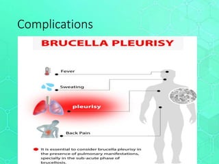Unveiling Brucellosis: Understanding its Classifications, Diagnosis ...