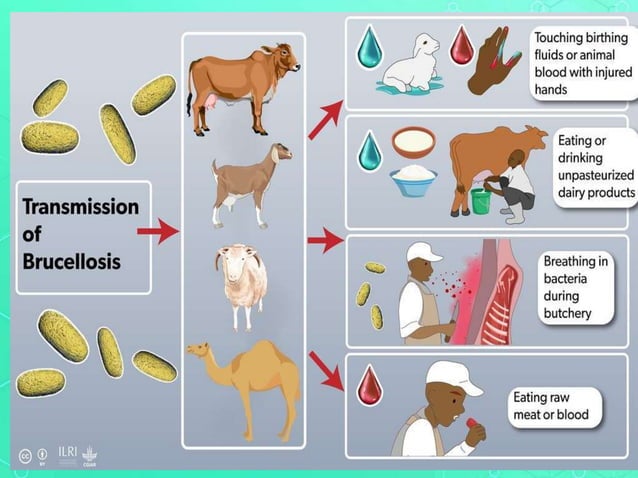 Unveiling Brucellosis: Understanding its Classifications, Diagnosis ...