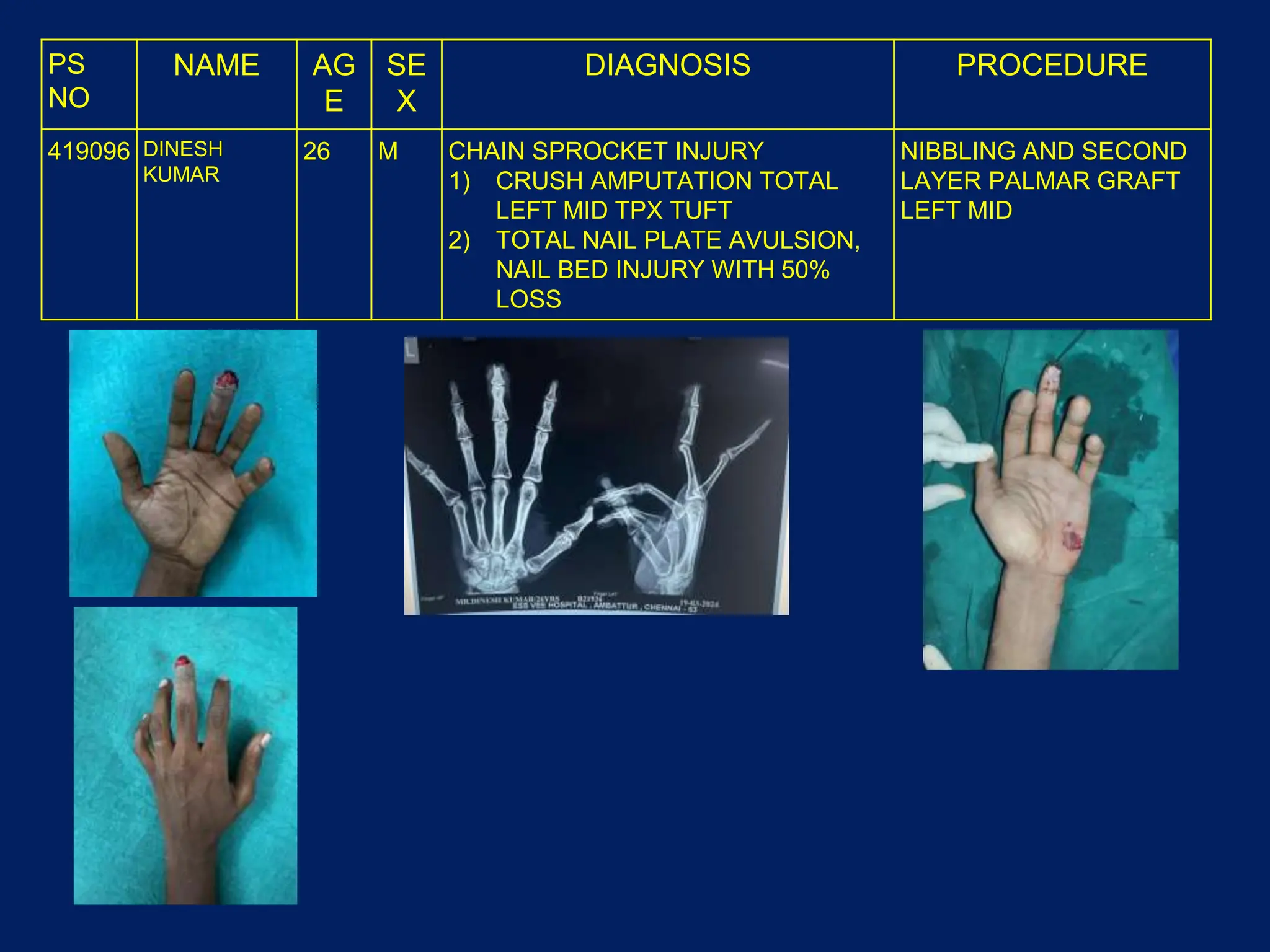 Hand injury treated in different ways.pptx