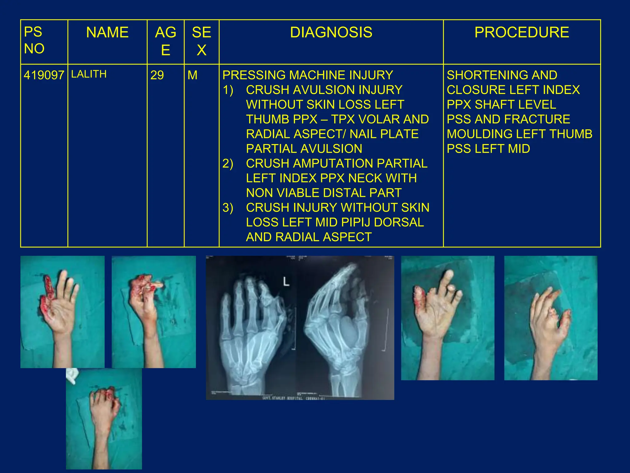 Hand injury treated in different ways.pptx