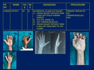 Hand injury treated in different ways.pptx