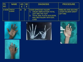 Hand injury treated in different ways.pptx