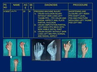 Hand injury treated in different ways.pptx