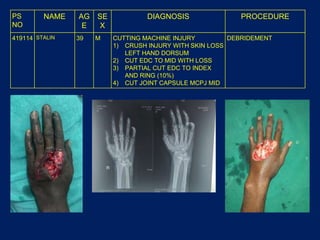 Hand injury treated in different ways.pptx