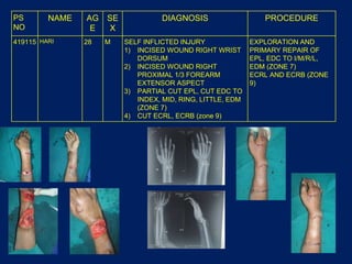 Hand injury treated in different ways.pptx