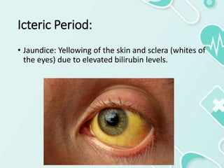 Clinical Manifestations Of Acute Viral Hepatitis | PPTX