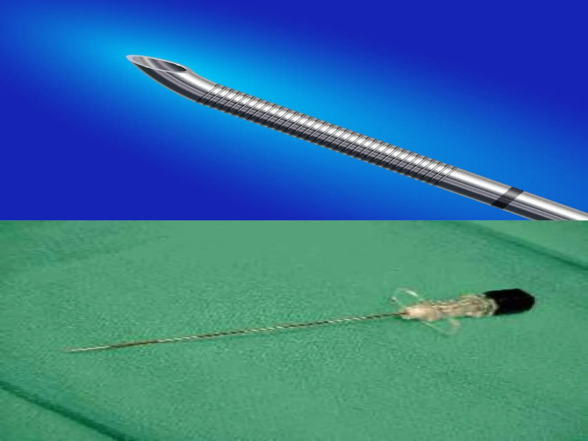Epidural Needle For Anesthesia Technologist | PPTX