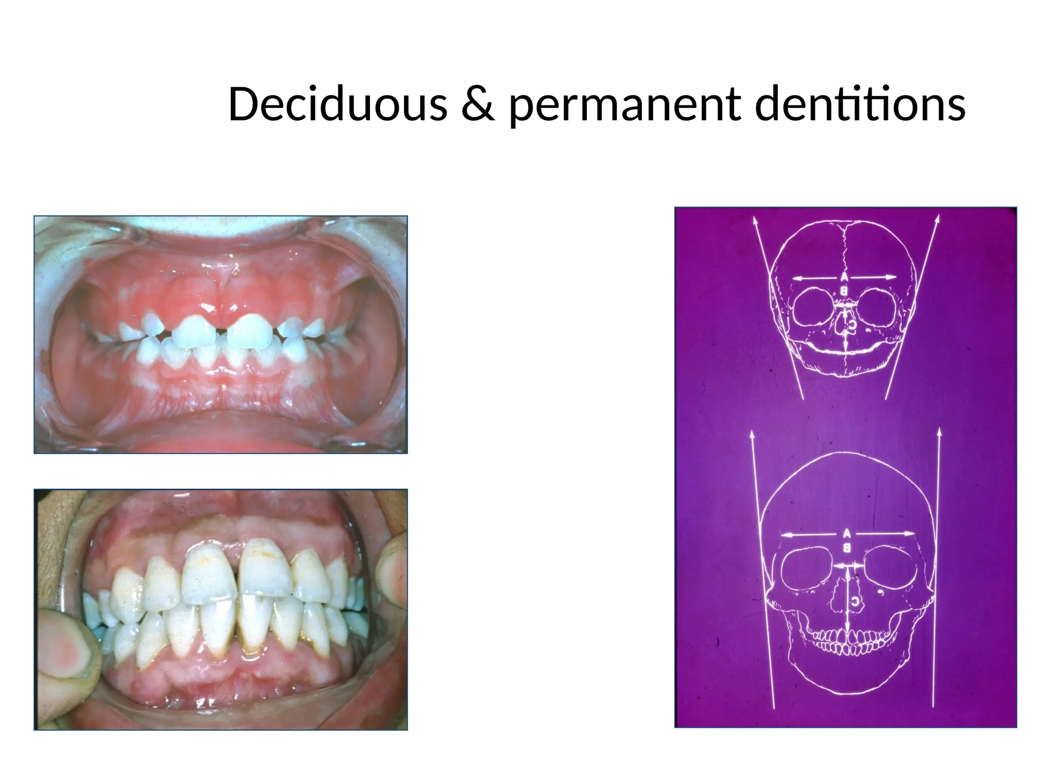 Tooth numbering system for BDS students.pptx
