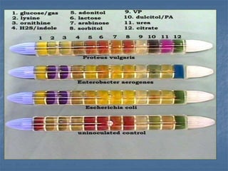 The Process of GRAM STAINING of specimens | PPT