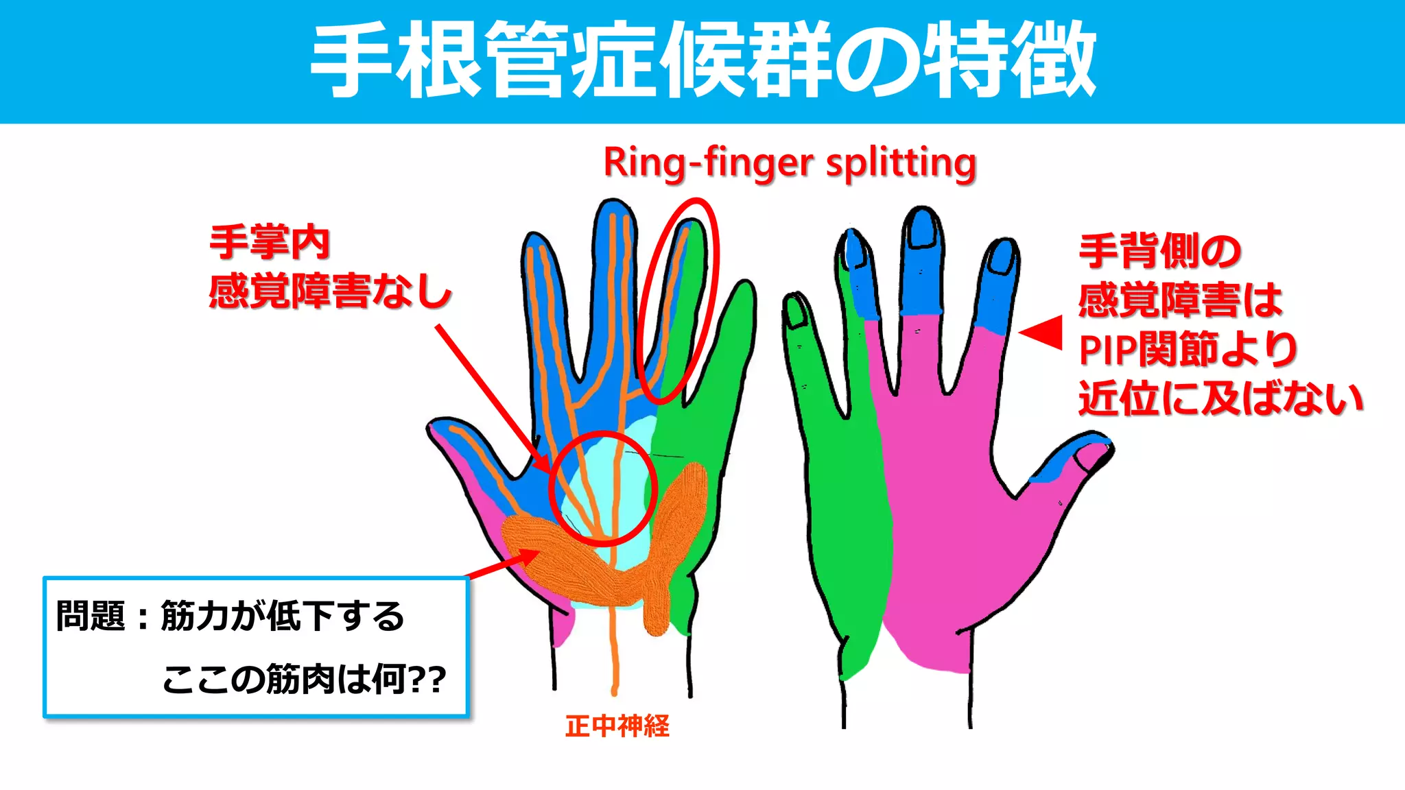 上肢の痺れ | PDF